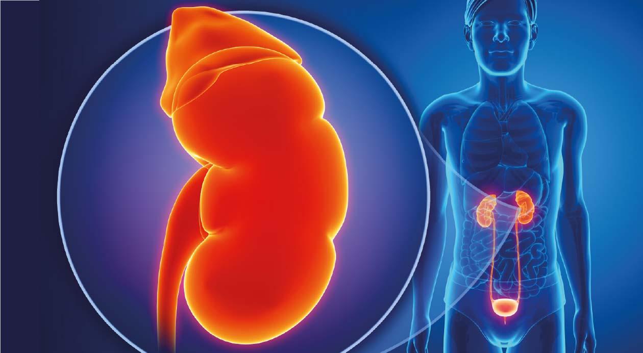 En España se detectan más de 7.300 casos de cáncer renal cada año ...