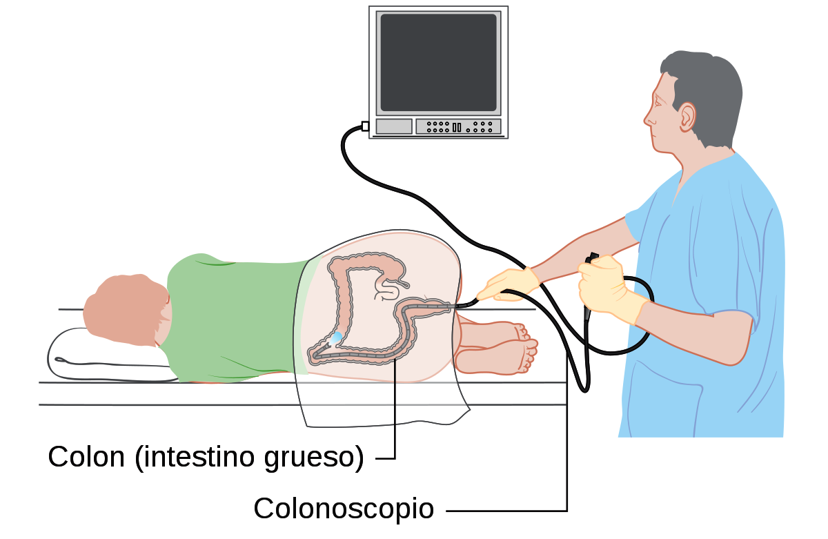 Validan un test de biopsia líquida en sangre para detectar cáncer de ...